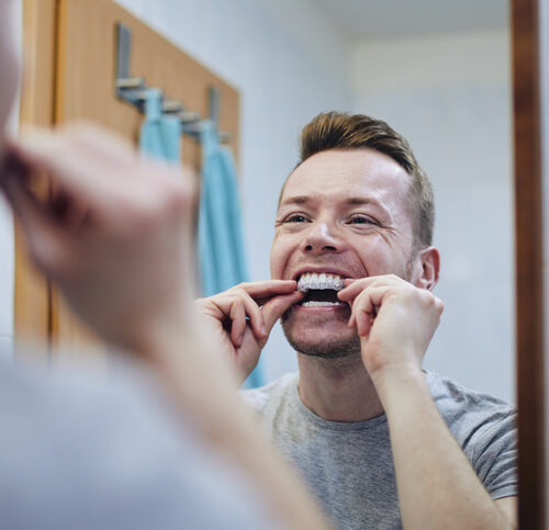 How Much Do Retainers Cost? | Lazzara Orthodontics